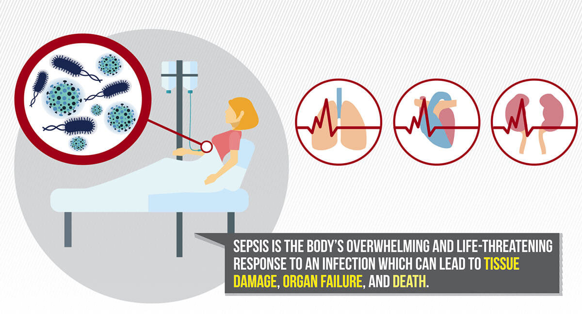 bioMérieux Sepsis | Captiva Studios Animation